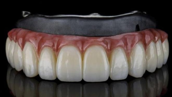 Suprastruktura tytan/trinia/cyrkon Aidite 3D cutback – CadMe